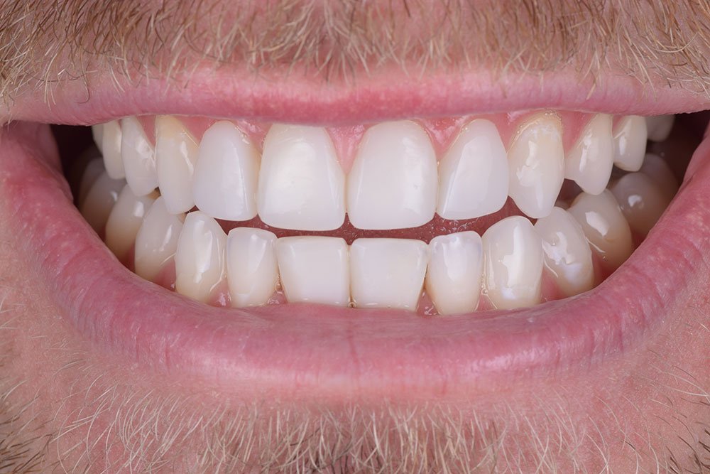 Case Studies Corstorphine - Dentist Edinburgh